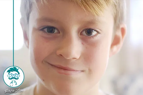 آیا فلج بلز خطرناک است؟ مدت زمان درمان قطعی فلج بلز + علل